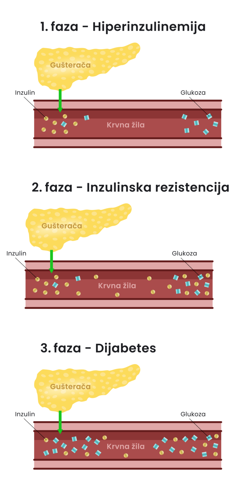 Inzulinska rezistencija i mršavljenje - LightFork